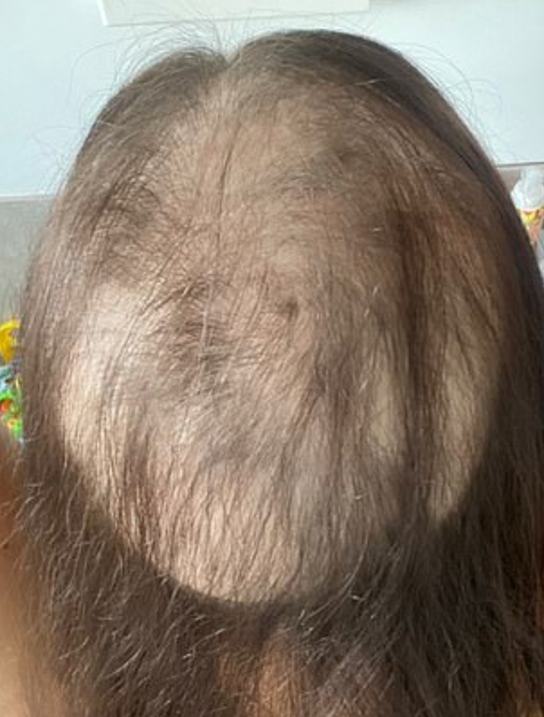 Hair Revival Serum – VortexHairCare