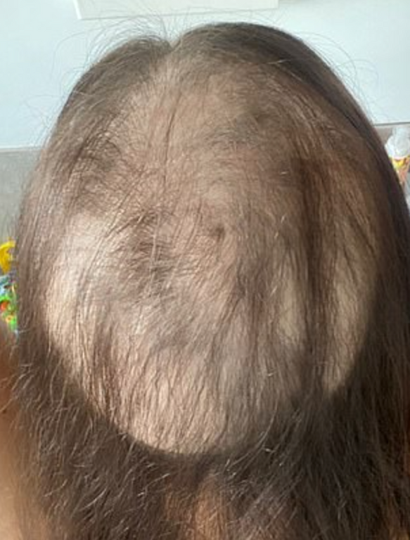 Hair Revival Serum – VortexHairCare