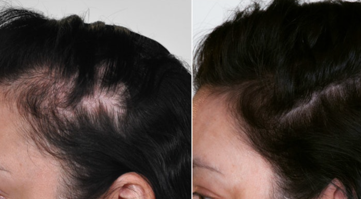 Hair Revival Serum – VortexHairCare