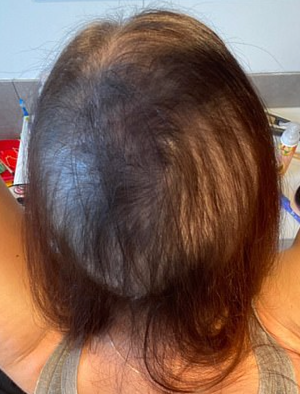 Hair Revival Serum – VortexHairCare