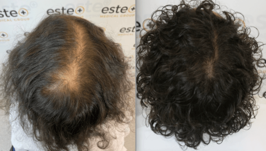 Hair Revival Serum – VortexHairCare