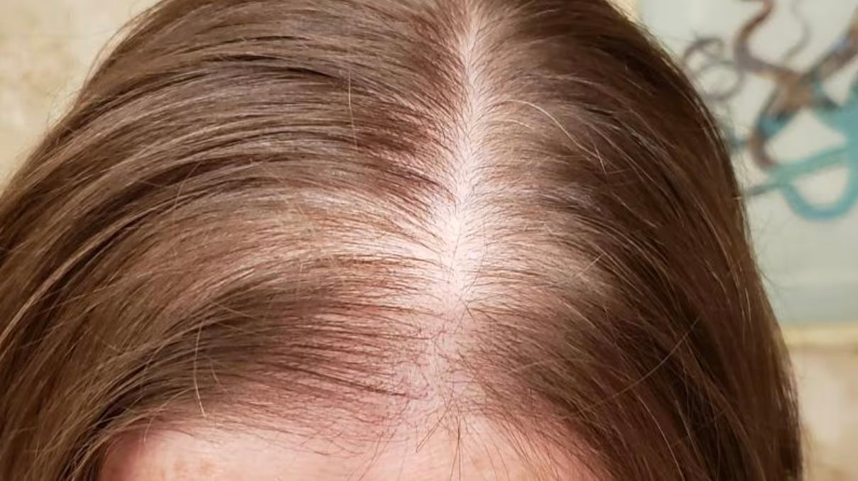 Hair Revival Serum* – VortexHairCare