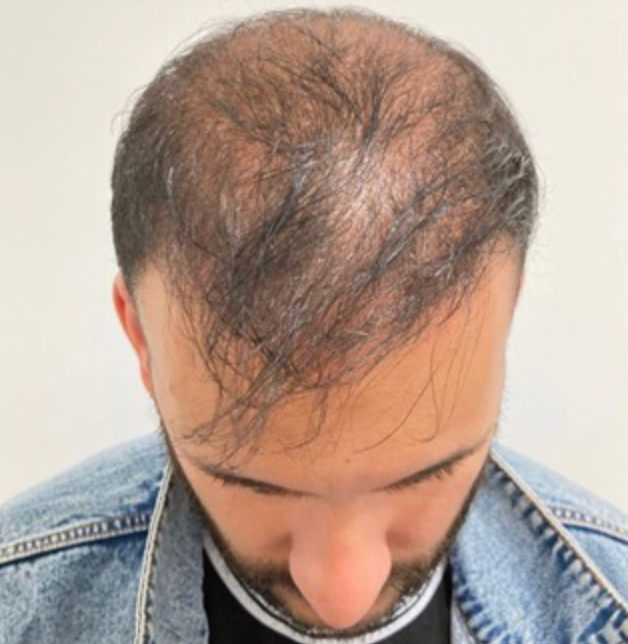 Vortex Comb Bundle – VortexHairCare