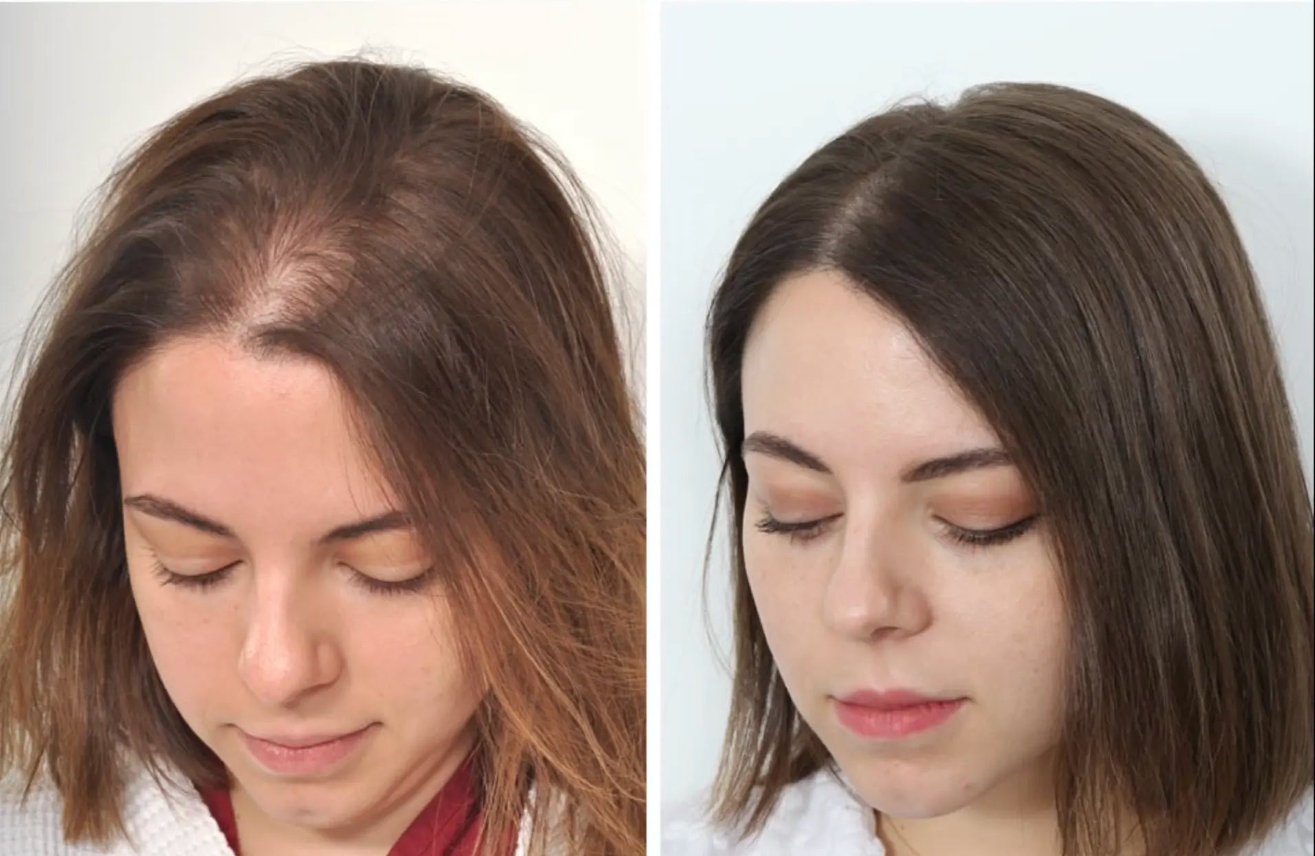 Hair Revival Serum* – VortexHairCare