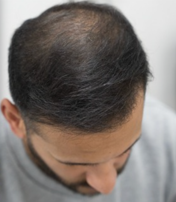 Vortex Comb Bundle – VortexHairCare